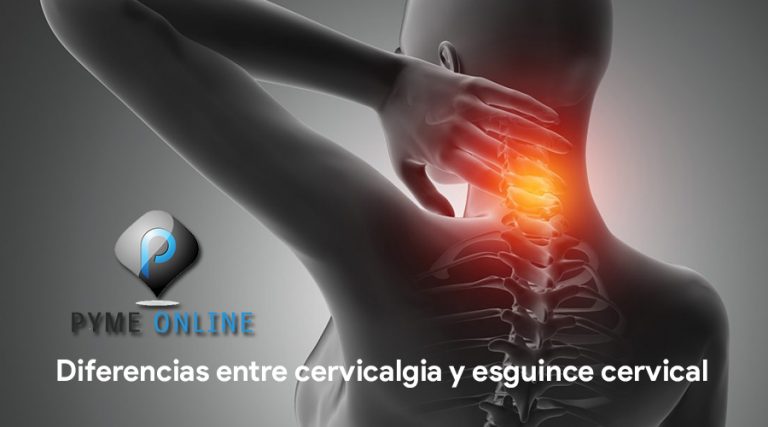 Diferencias entre cervicalgia y esguince cervical - PymeOnline.es ...